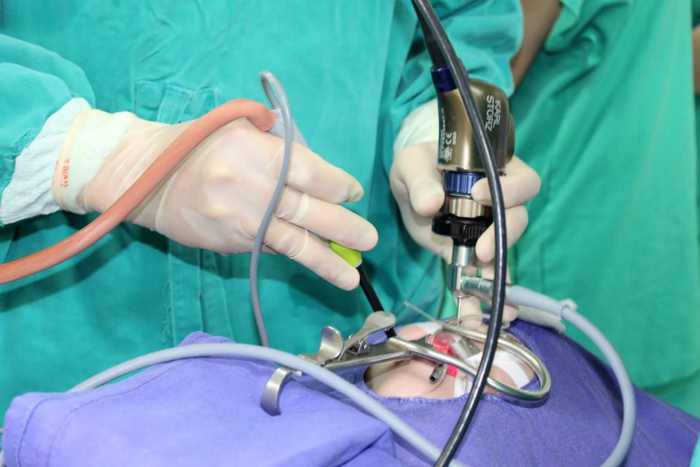 Dao mổ Plasma là gì? Nguyên lý hoạt động và giá bao nhiêu? - Bát Chánh Đạo
